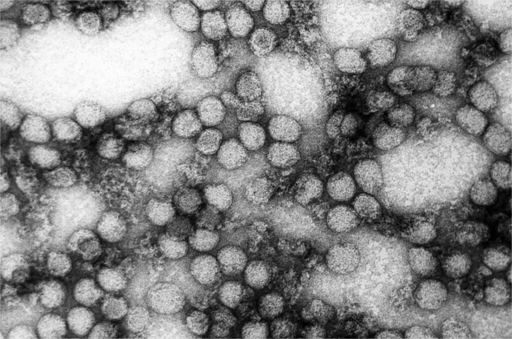 Stubbins Ffirth, le médecin qui avalait du vomi noir pour étudier la ...