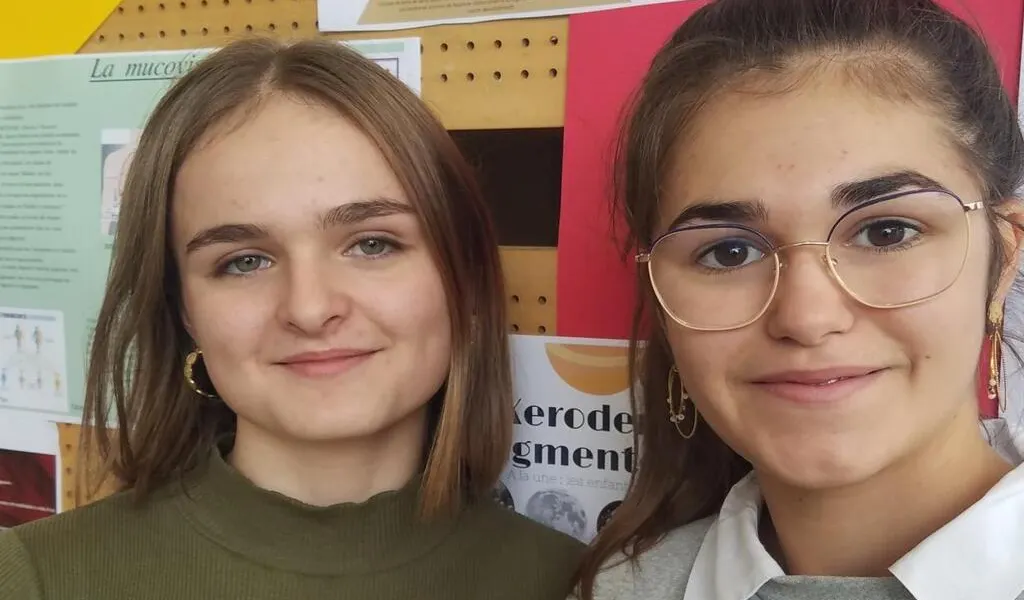 Saint-Grégoire. Le syndrome de Seckel - Redon.maville.com