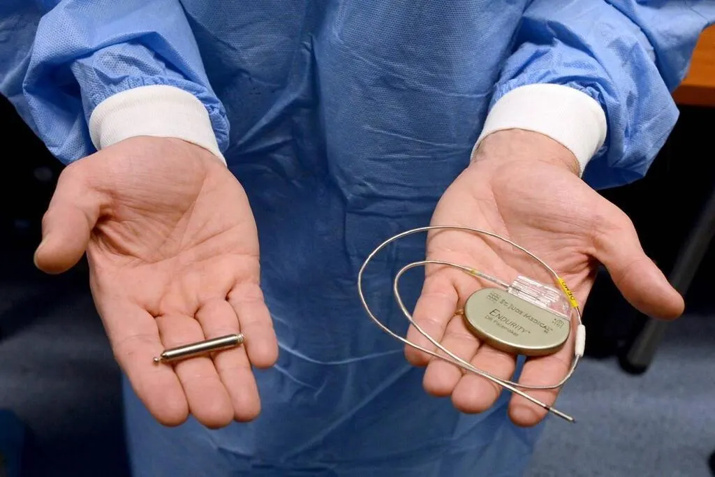 En Ille-et-Vilaine, la crémation du défunt retardée à cause d’un ...