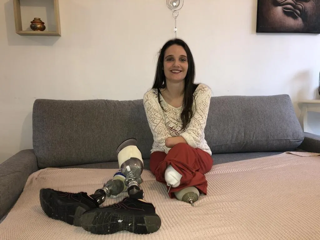 TÉMOIGNAGE. Amputée des pieds et des mains, Lucie, 42 ans, doit ...
