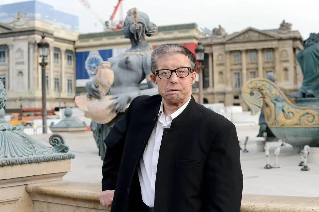 « Il était heureux de vivre » : qui était Jérôme Hamon, greffé deux ...