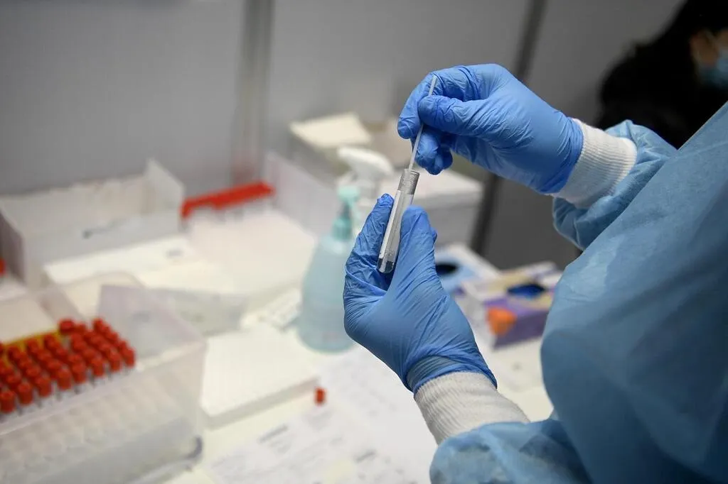 « Mon test IST » : un dépistage gratuit pour les moins de 26 ans à ...